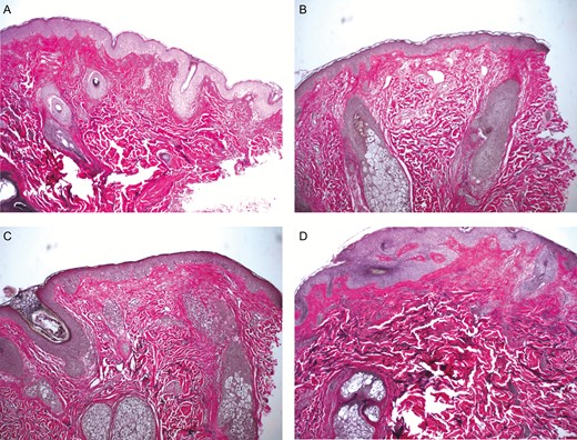 Topical Nanofat Biocreme for Skin Quality | Mr Tunç Tiryaki